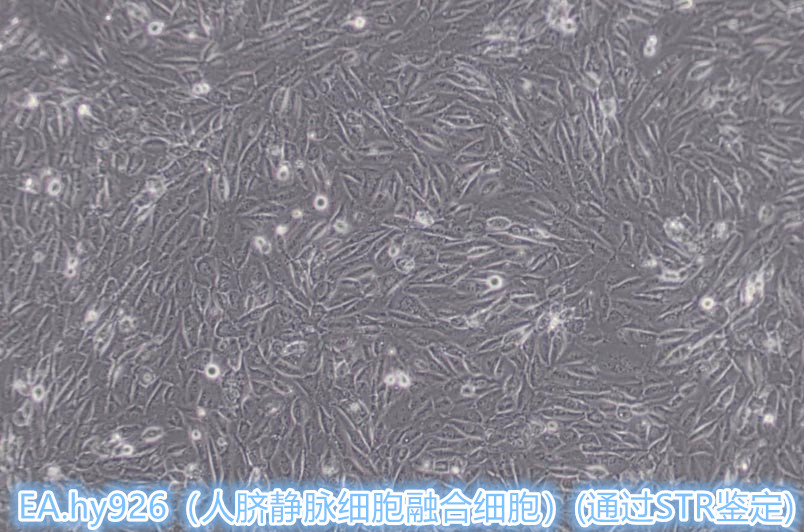 EA.hy926 / EA.hy926细胞 / EA.hy926人脐静脉细胞融合细胞价格,详情介绍-960化工网 – 960化工网
