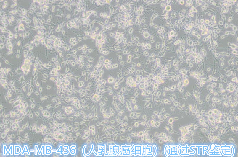 MDA-MB-436细胞 (人乳腺癌细胞) (DMEM) (STR鉴定正确)价格_品牌:Procell-丁香通官网