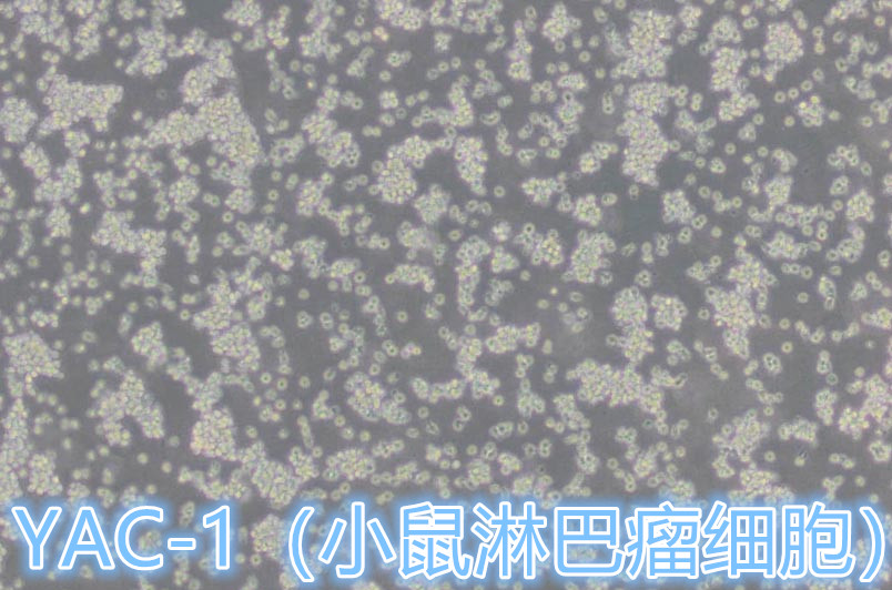 YAC-1 / YAC-1细胞 / YAC-1小鼠淋巴瘤细胞价格,详情介绍-960化工网 – 960化工网
