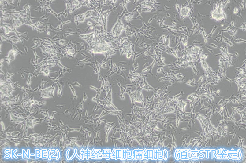 SK-N-BE(2)细胞 / SK-N-BE(2)人神经母细胞瘤细胞价格,详情介绍-960化工网 – 960化工网