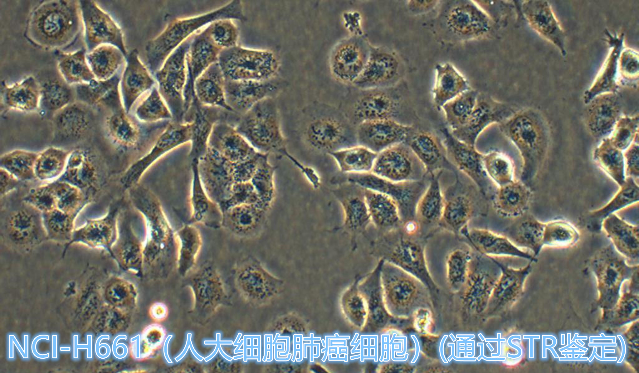 NCI-H661人大细胞肺癌细胞价格,详情介绍-960化工网 – 960化工网