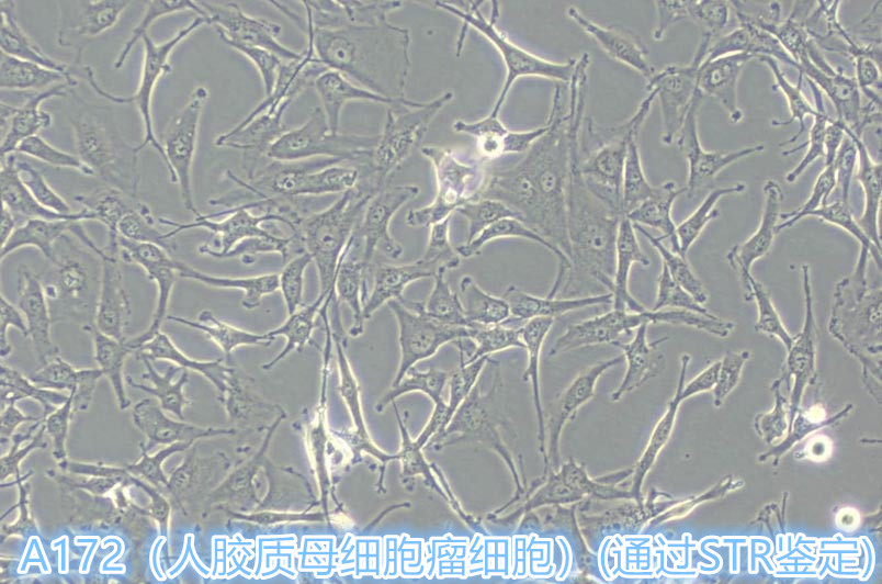 A172 / A172细胞 / A172人胶质母细胞瘤细胞价格,详情介绍-960化工网 – 960化工网