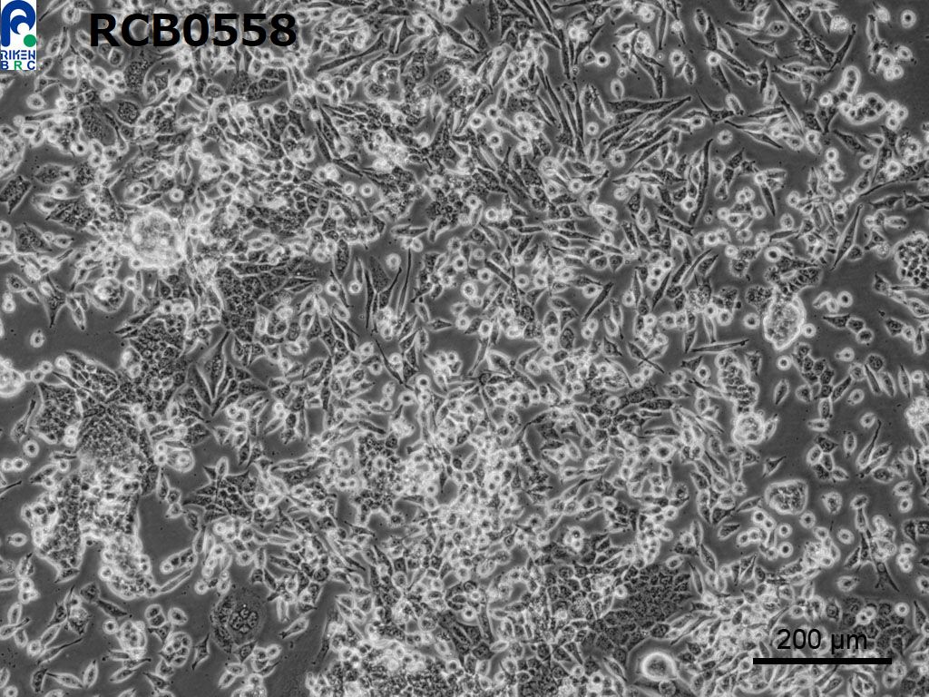 LLC【LL/2 (LLc1); LL/2(LLc1); LL/2; LL2; LLC1; Lewis lung carcinoma line ...