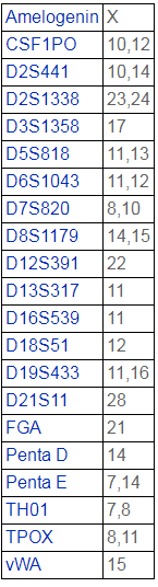 PANC-1[Panc-1; PANC.1; Panc 1; PanC1; Panc1; PANC1; Panc-1-P]人胰腺癌细胞价格,详情介绍-960化工网 – 960化工网