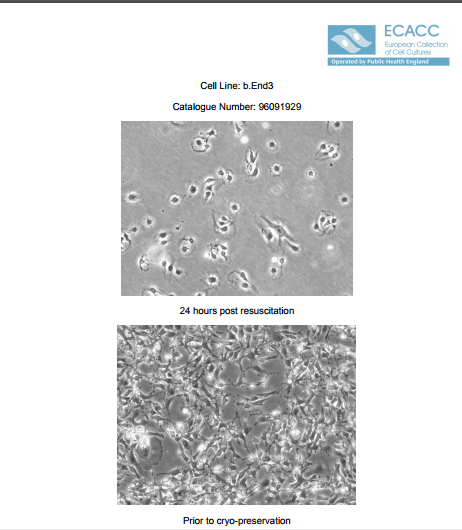 bEnd.3[bEND.3; b.End3; Bend.3; bEnd3; BEND3]小鼠脑微血管内皮细胞价格_品牌:澳音生物-丁香通官网