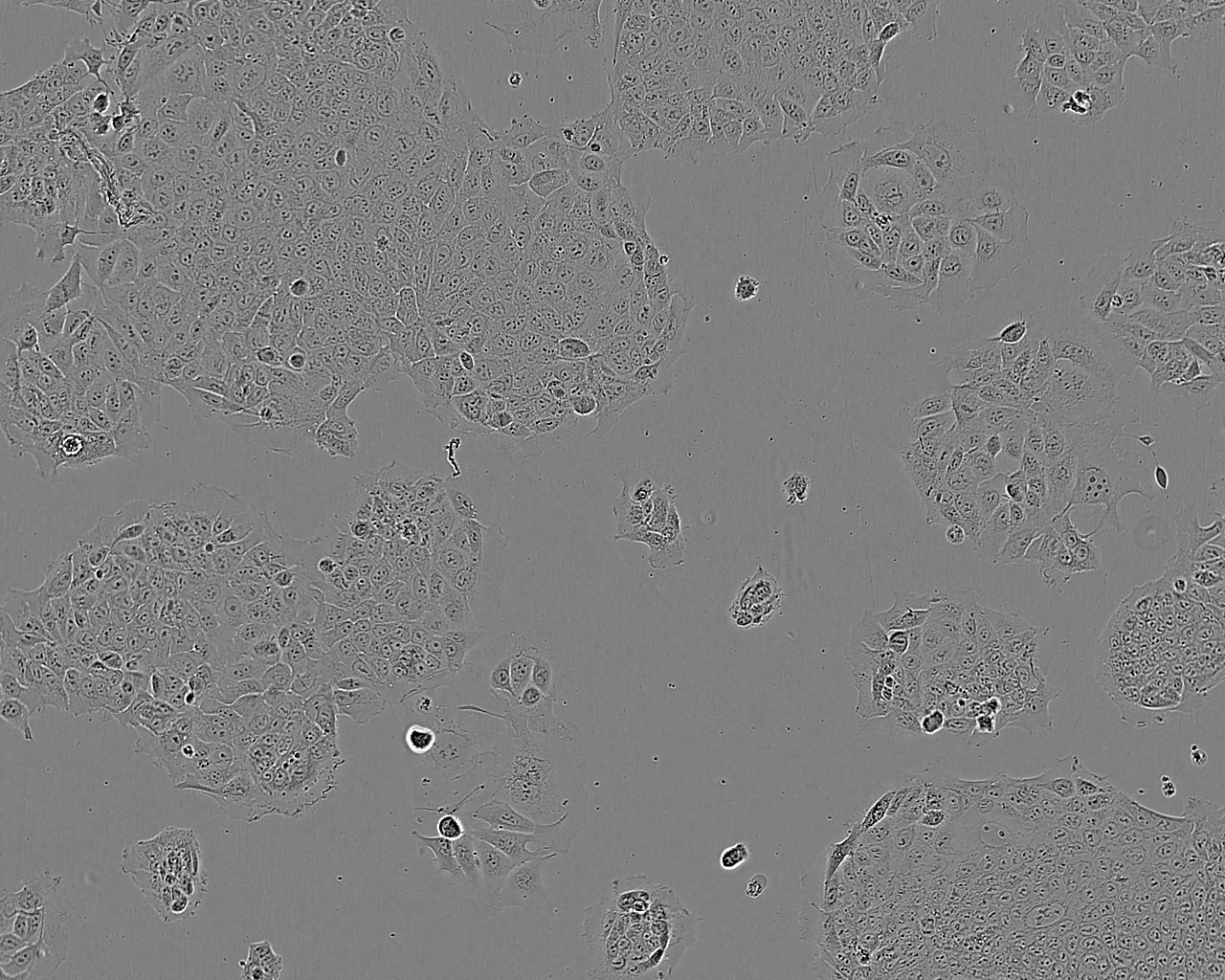 DLD-1[DLD 1; DLD1; CoCL3]人结直肠癌上皮细胞价格_品牌:澳音生物-丁香通官网