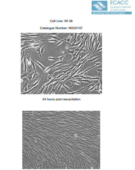 WI-38[Wi-38; WI 38; WI38; Wistar Institute-38; AG06814-J; AG06814-M]人胚肺 ...