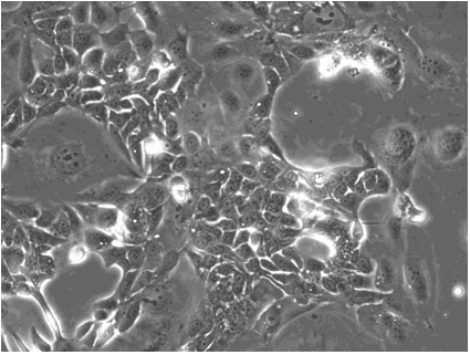 LC-2/AD[LC-2-Ad; LC-2-ad; LC-2 ad; LC2/Ad; LC2/AD]人肺癌腺癌细胞价格,详情介绍-960化工网 ...