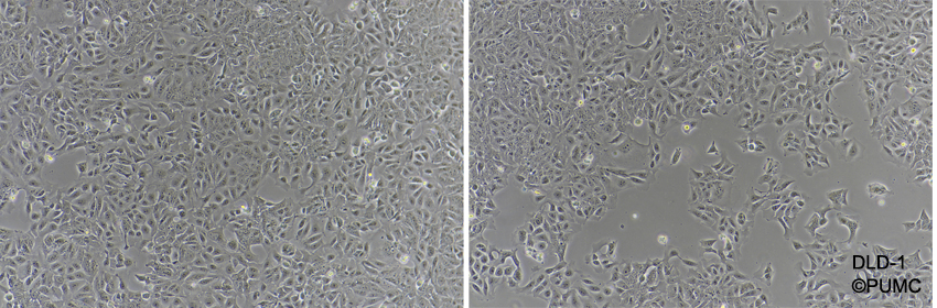 DLD-1[DLD 1; DLD1; CoCL3]人结直肠癌上皮细胞价格_品牌:澳音生物-丁香通官网