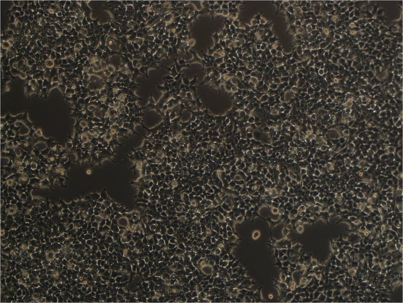 HEK293T/17[HEK 293T/17; 293T/17]SV40T转化的人胚肾细胞（亚系）价格,详情介绍-960化工网 – 960化工网