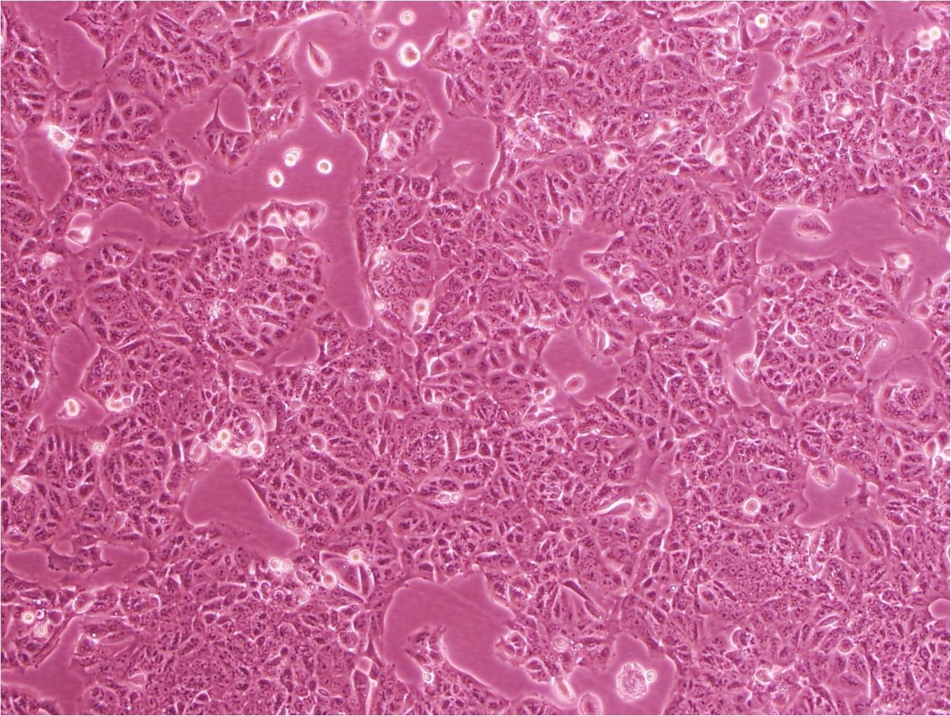 DLD-1[DLD 1; DLD1; CoCL3]人结直肠癌上皮细胞价格_品牌:澳音生物-丁香通