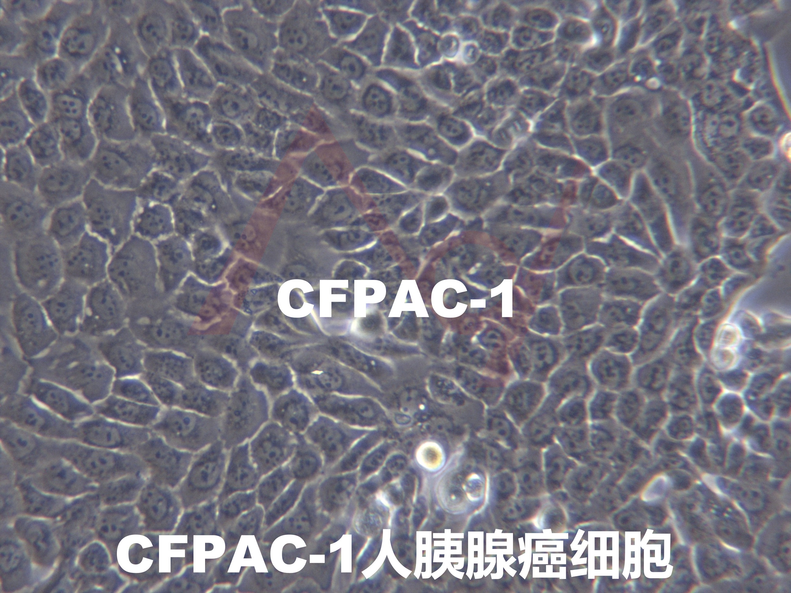 CFPAC-1[ CFPac-1; CF PAC-1; CF-PAC1; CF-Pac1; CF Pac1; CFPAC1; CFPAC]人 ...
