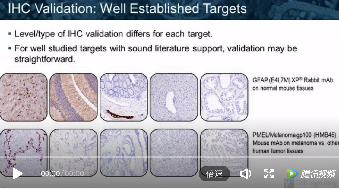 mIHC讲座回看 | 使用OPAL IHC方法和CST抗体在小鼠组织上进行多重成像-国内聚焦-生物在线 Lab-on-Web