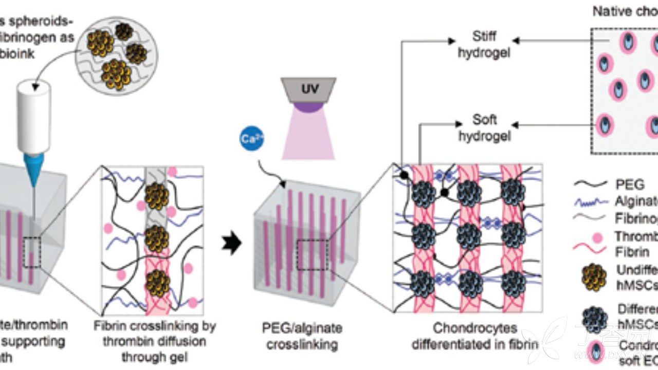 AFM：悬浮支撑打印类软骨组织 - 丁香园论坛