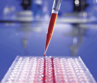 CircuLex Human PCSK9 ELISA Kit价格,详情介绍-960化工网 – 960化工网