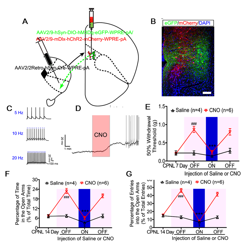 研究新进展 | 疼痛与焦虑行为研究 - 企业动态 - 丁香通