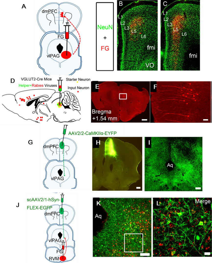 研究新进展 | 疼痛与焦虑行为研究-公司新闻-武汉枢密脑科学技术有限公司