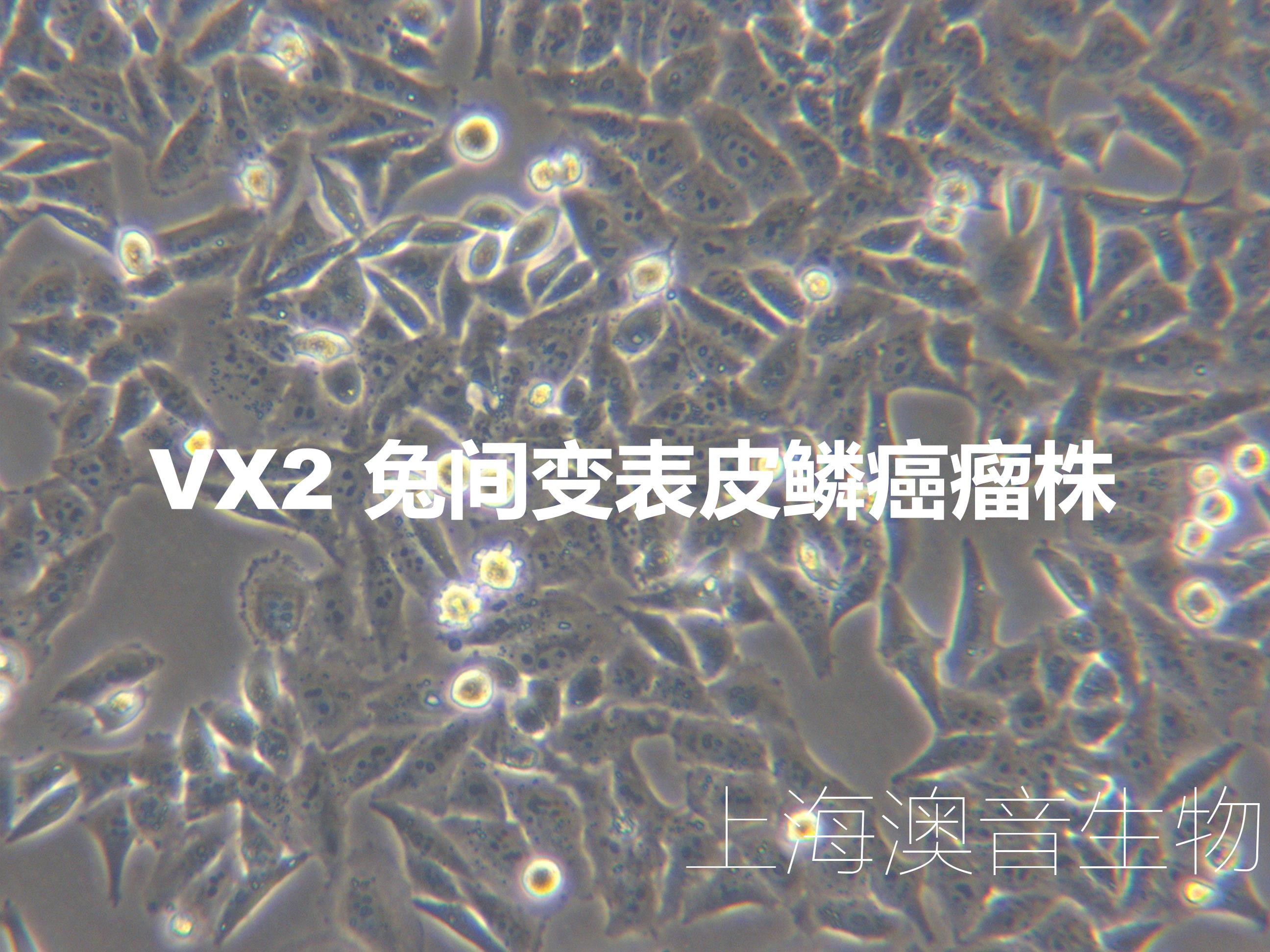 VX2[Vx2; Vx-2; VX-2] 兔间变表皮鳞癌瘤株价格,详情介绍-960化工网 – 960化工网