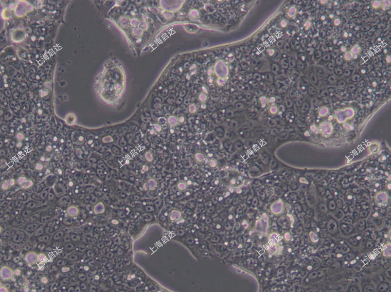 NCI-N87 [N87]人胃癌细胞价格,详情介绍-960化工网 – 960化工网