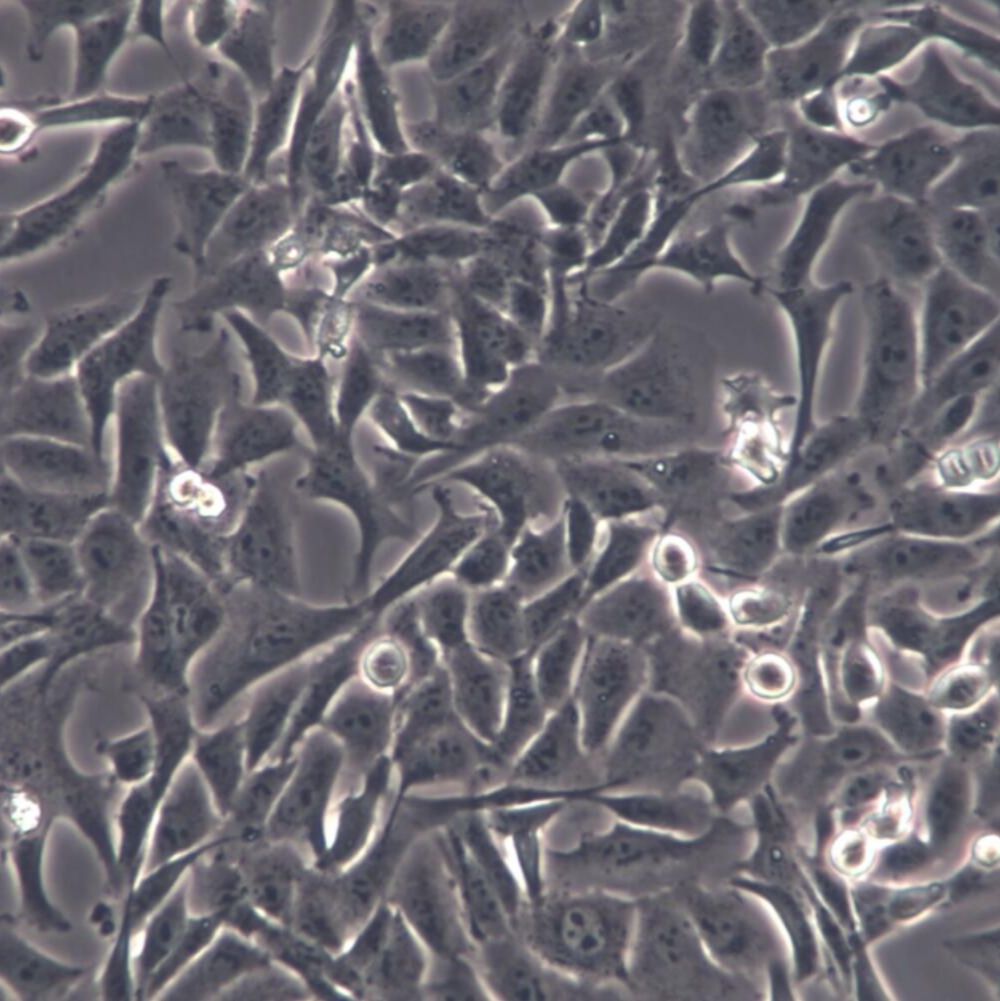 143B细胞、143B细胞、143B骨肉瘤细胞价格_品牌:ATCC,DSMZ, ECACC, RIKEN -丁香通官网