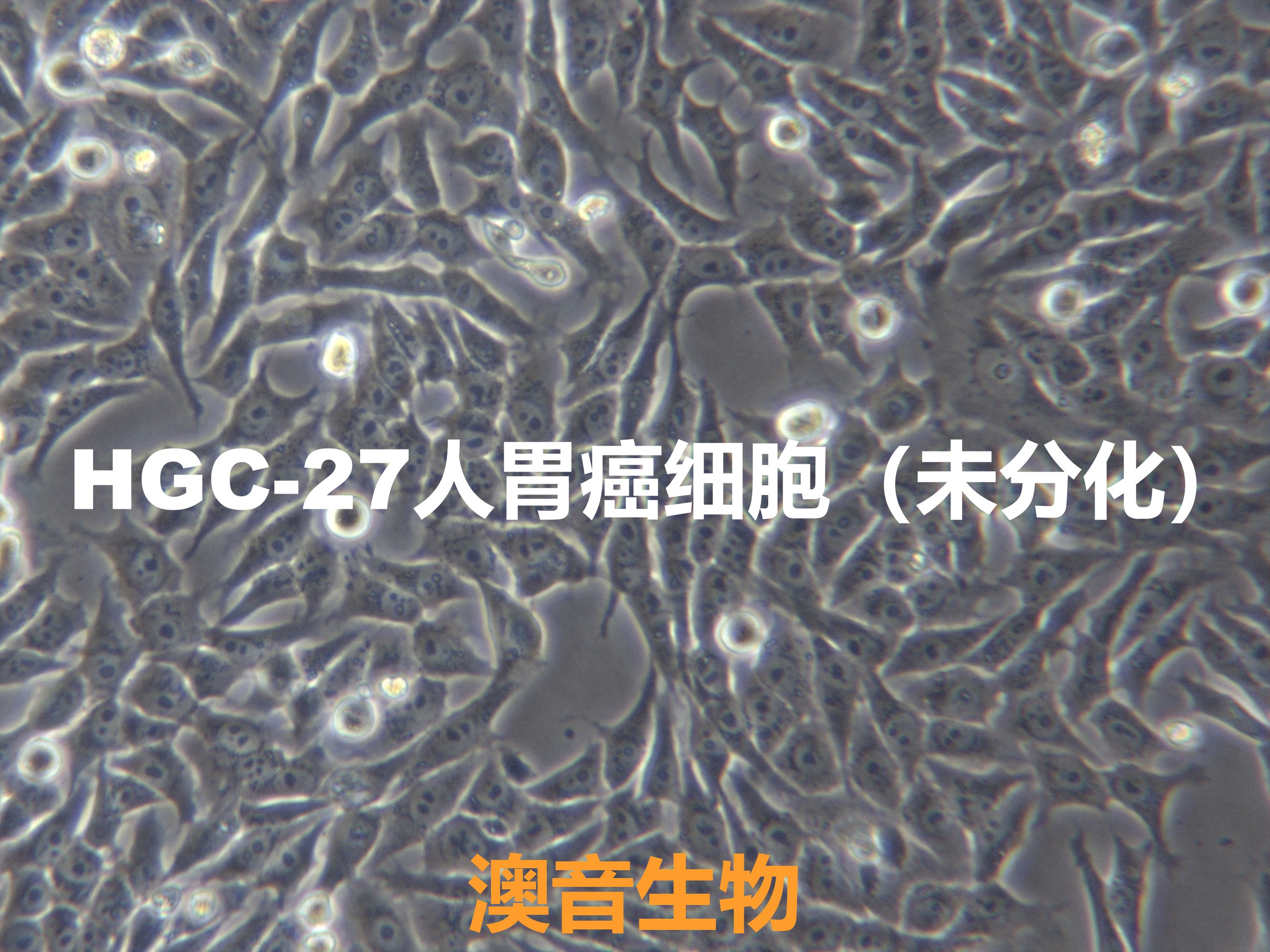 HGC-27[HGC 27; HGC27]人胃癌细胞（未分化）价格_品牌:澳音生物-丁香通官网