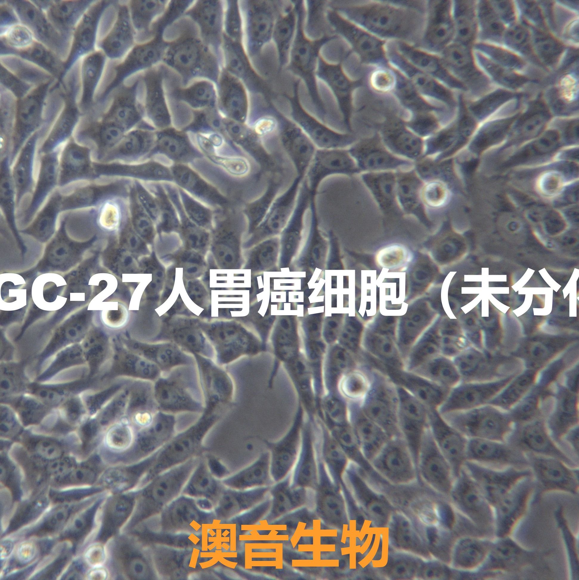 HGC-27[HGC 27; HGC27]人胃癌细胞（未分化）价格_品牌:澳音生物-丁香通官网