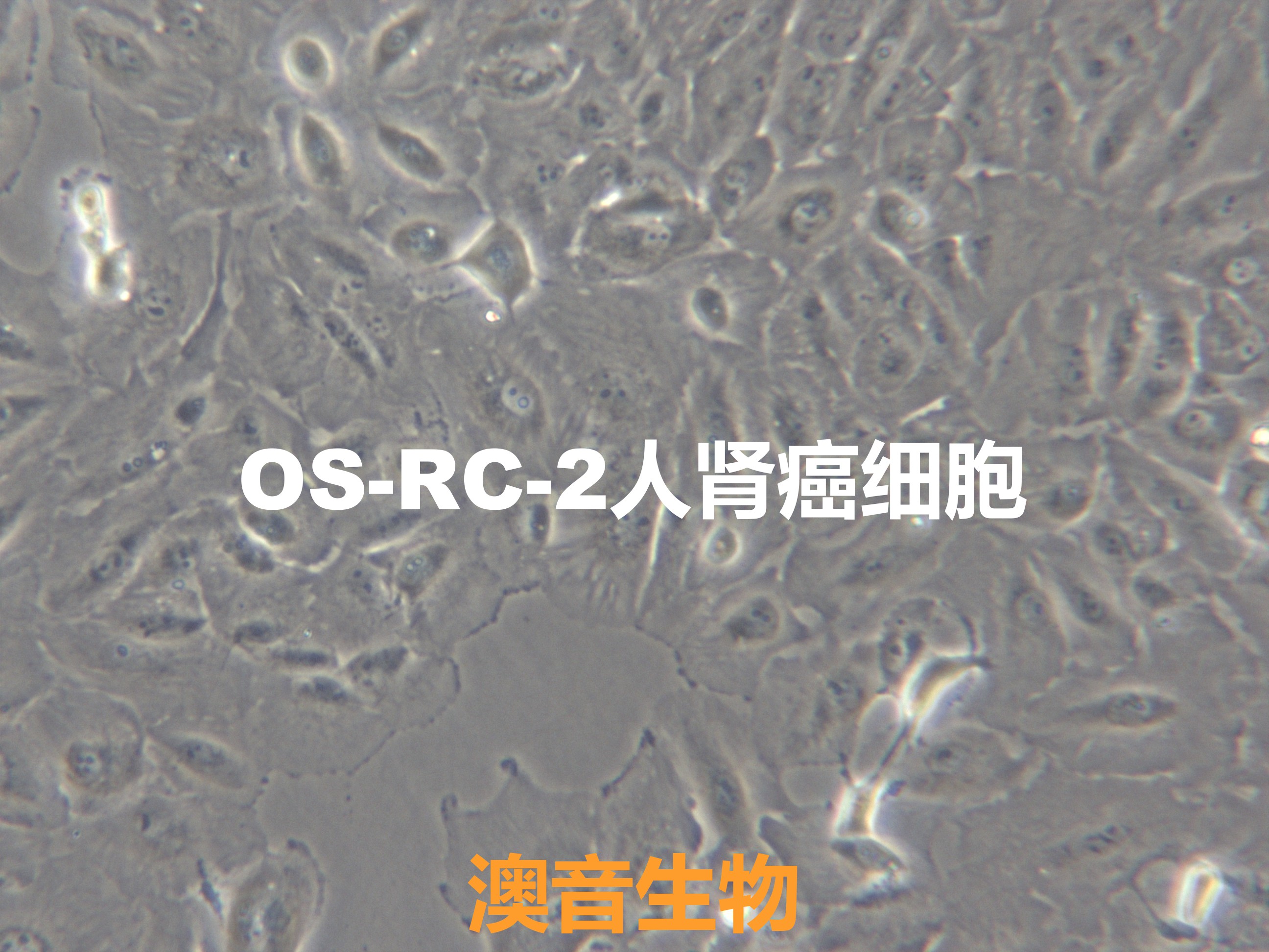 OS-RC-2[OSRC2; RC-2]人肾癌细胞价格_品牌:澳音生物-丁香通