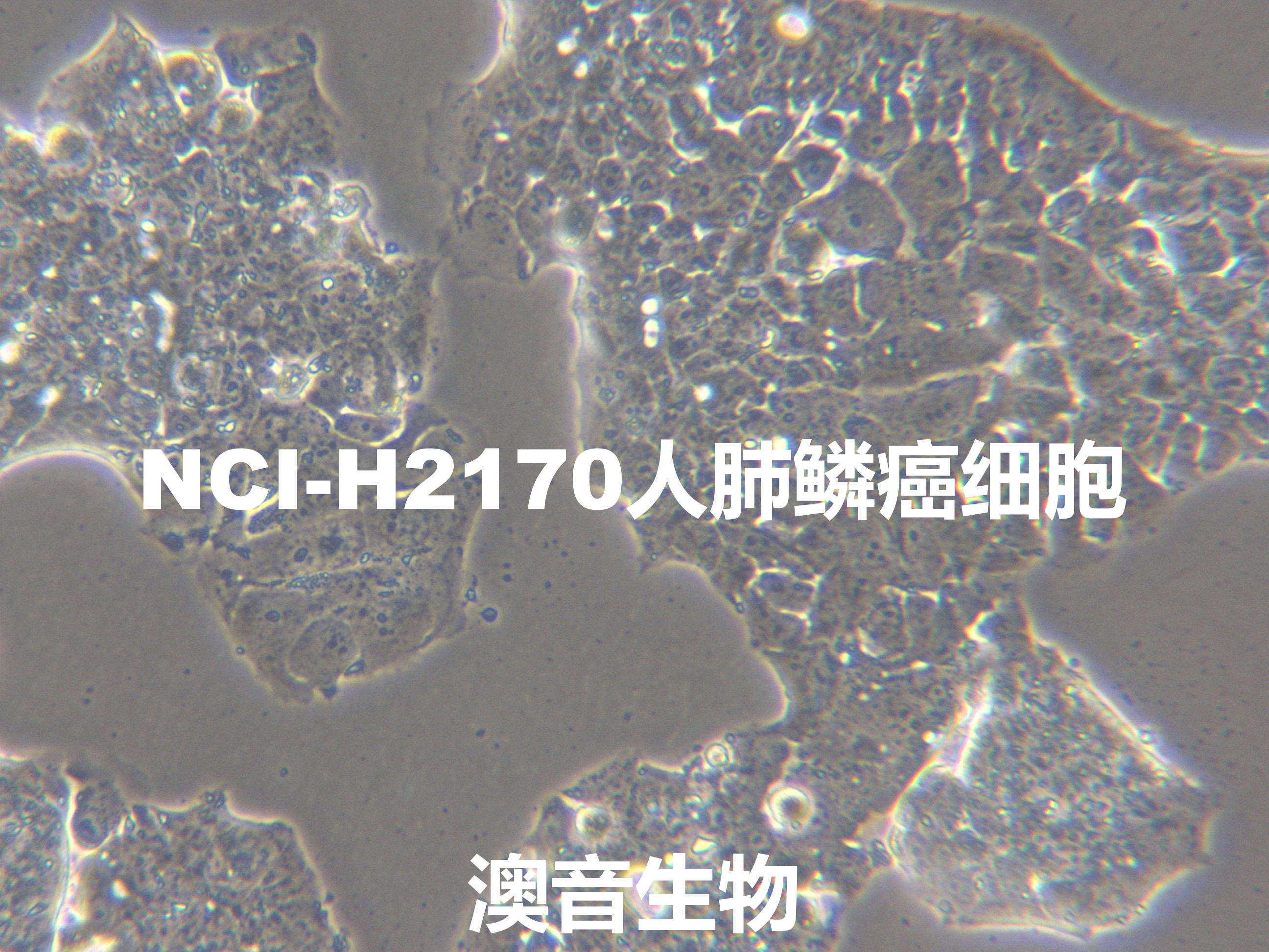 NCI-H2170[H2170; H-2170; NCIH2170]人肺鳞癌细胞价格_品牌:澳音生物-丁香通