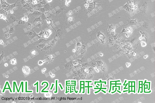 AML12[AML-12]小鼠肝实质细胞价格,详情介绍-960化工网 – 960化工网