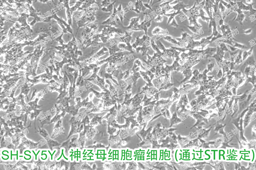 SH-SY5Y[SHSY5Y; SHSY-5Y; SK-SH-SY5Y]人神经母细胞瘤细胞品牌：WHELAB美国/国内传代-盖德化工网
