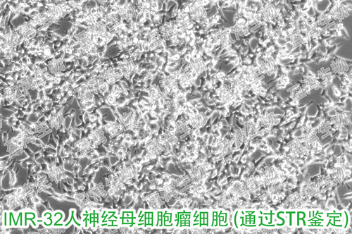 IMR-32[IMR 32; IMR32]人神经母细胞瘤细胞价格,详情介绍-960化工网 – 960化工网
