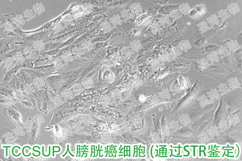 TCCSUP[TCCSuP; TCC-SUP; TCC Sup]人膀胱癌细胞价格,详情介绍-960化工网 – 960化工网