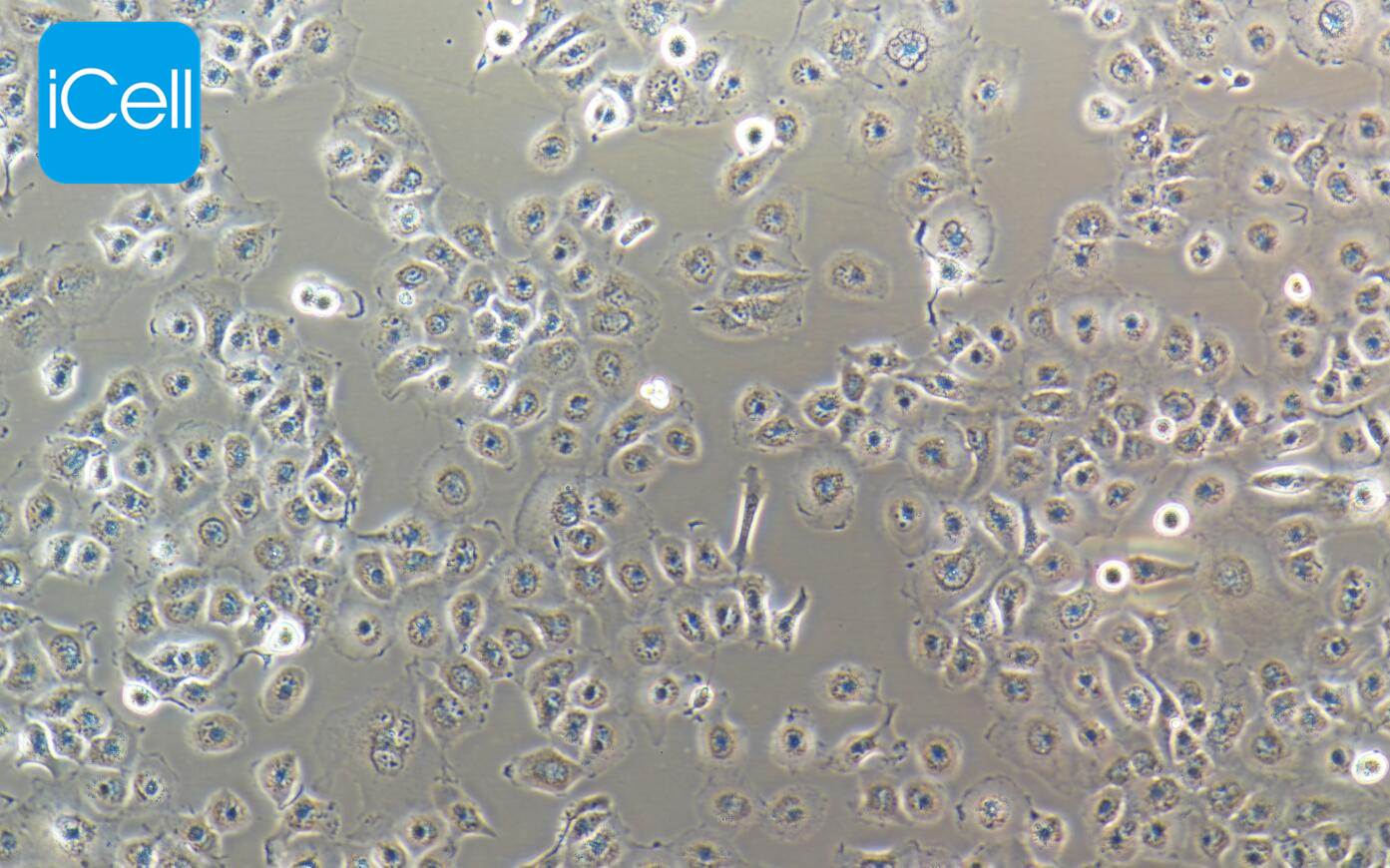 NCI-H660 人神经内分泌前列腺癌细胞 赛百慷 iCell价格,详情介绍-960化工网 – 960化工网
