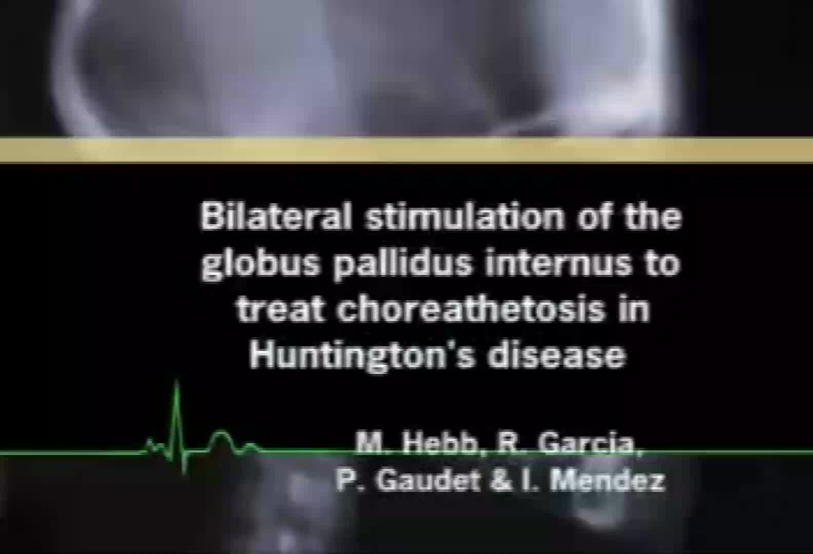 Functional gait disorders
