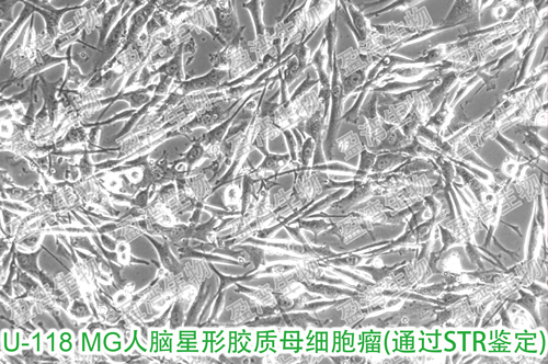 U-118 MG[U-118-MG; U118-MG; U118MG; U118; 118 MG; 118MG]人脑星形胶质母细胞瘤品牌 ...