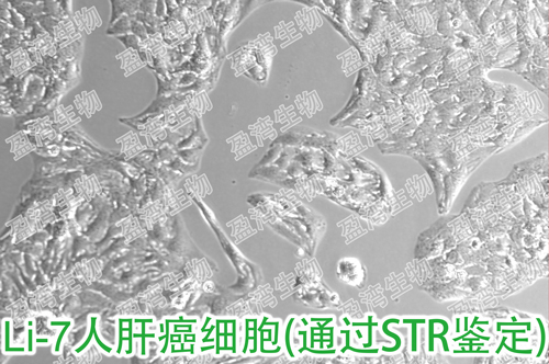 Li-7[LI7; Li7; C-Li-7]人肝癌细胞价格,详情介绍-960化工网 – 960化工网