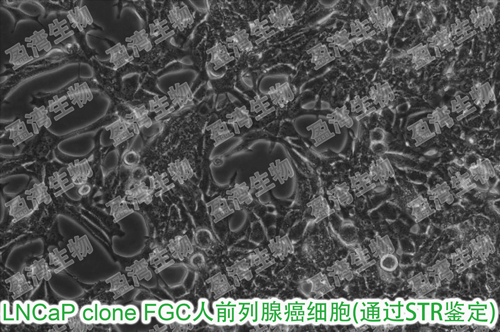 LNCaP clone FGC[LNCaP-Clone-FGC;LNCaP-FGC;LNCaP FGC]人前列腺癌细胞价格,详情介绍-960化工网 – 960化工网