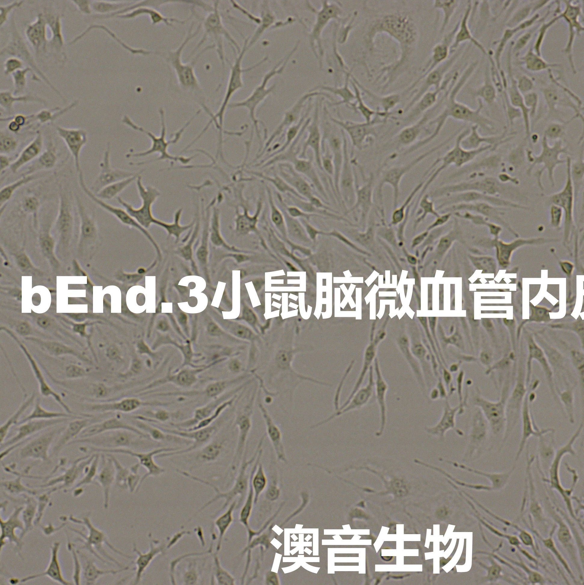 bEnd.3[bEND.3; b.End3; Bend.3; bEnd3; BEND3]小鼠脑微血管内皮细胞价格_品牌:澳音生物-丁香通官网