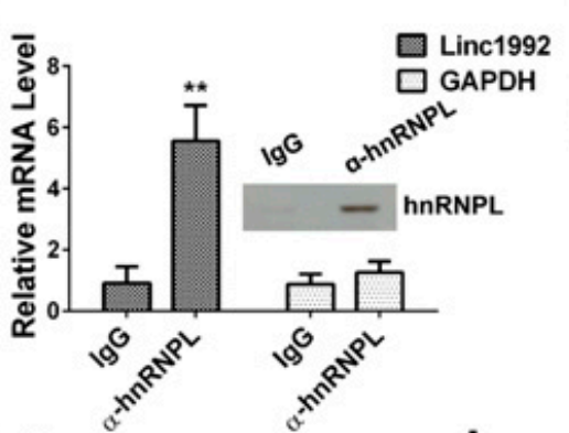 超详细！手把手教你做 RNA pull down（图文并茂，提供完整讲座、直播回放）_公司新闻_丁香通