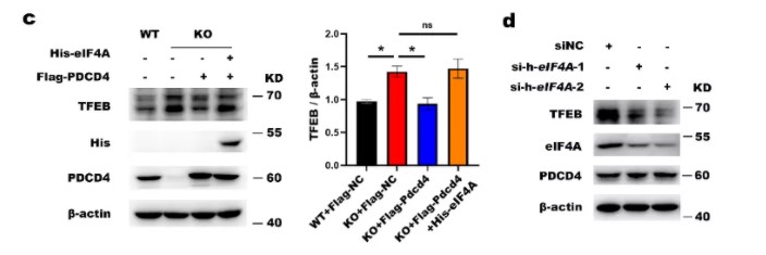 Cell Death Differ：山大张利宁教授团队首次揭示TFEB在蛋白质翻译水平上的调控机制 - 技术前沿 - 资讯 - 生物在线