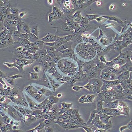 HPAC人胰腺癌细胞(STR鉴定)丨hpac细胞丨逸漠(immocell)价格_品牌:IMMOCELL-丁香通