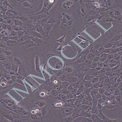 NP69 人鼻咽上皮细胞（STR鉴定）价格_品牌:IMMOCELL-丁香通官网