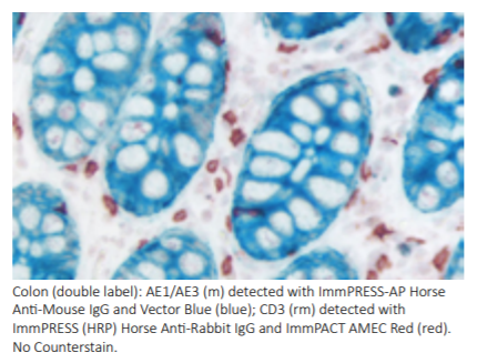 ImmPress AP anti Mouse Ig Kit 50 ml马抗小鼠IgG聚合物检测试剂盒，AP系统价格,详情介绍-960化工网 – ...
