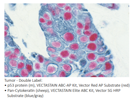 VECTASTAIN ABC-AP KIT RABBIT IgGVECTASTAIN ABC-AP免疫组化试剂盒（RABBIT IgG）价格 ...