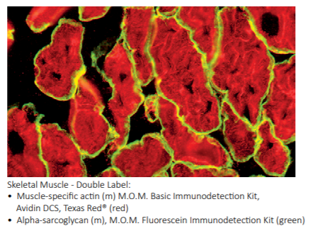 VECTOR MOM KIT (BASIC)mouse on mouse内源性鼠IgG封闭试剂盒（基础）价格,详情介绍-960化工网 – 960化工网