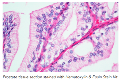HEMATOXYLIN AND EOSIN STAIN KIT苏mu精/苏木素和伊红染色试剂盒价格,详情介绍-960化工网 – 960化工网