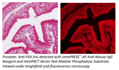 ImmPACT Vector Red Substrate KitImmPACT Vector Red底物价格,详情介绍-960化工网 – 960化工网