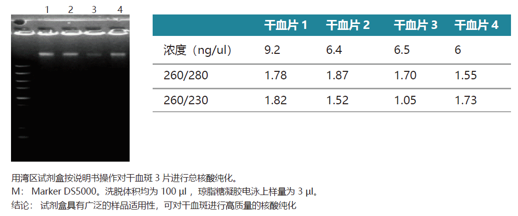 Baypure磁珠法干血斑DNA提取试剂盒价格_品牌:广州湾区生物-丁香通官网