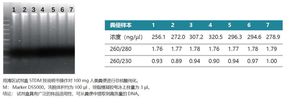 Baypure 磁珠法粪便DNA提取试剂盒价格,详情介绍-960化工网 – 960化工网