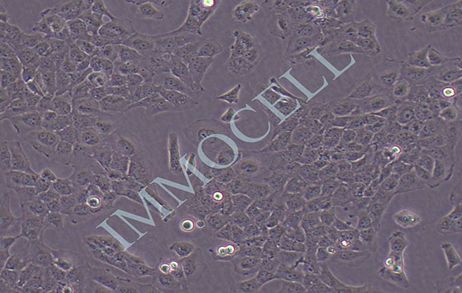 NP69 人鼻咽上皮细胞（STR鉴定）价格_品牌:IMMOCELL-丁香通官网
